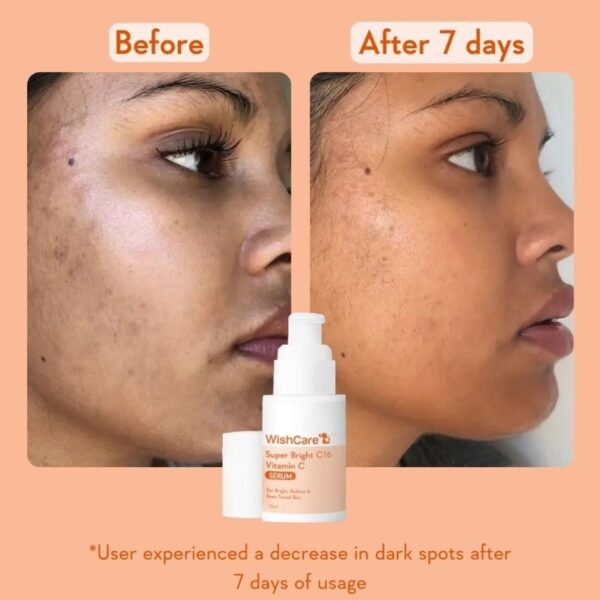 WishCare Super Bright C16 Vitamin C Serum – 30ml | For ...